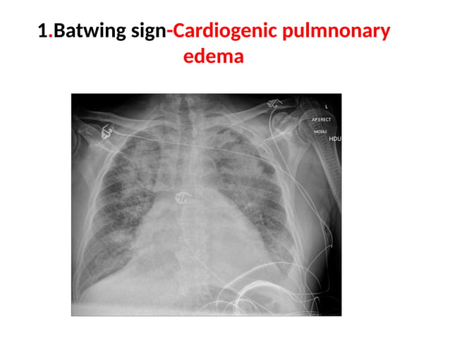 RADIOLOGY SIGNS JULY24 signs signs signed.pptx