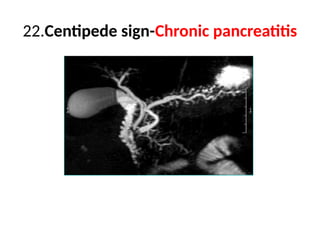 RADIOLOGY SIGNS JULY24 signs signs signed.pptx