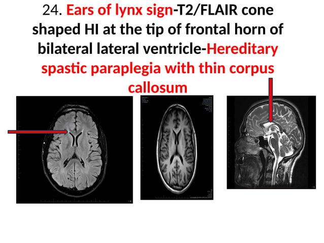 RADIOLOGY SIGNS JULY24 signs signs signed.pptx