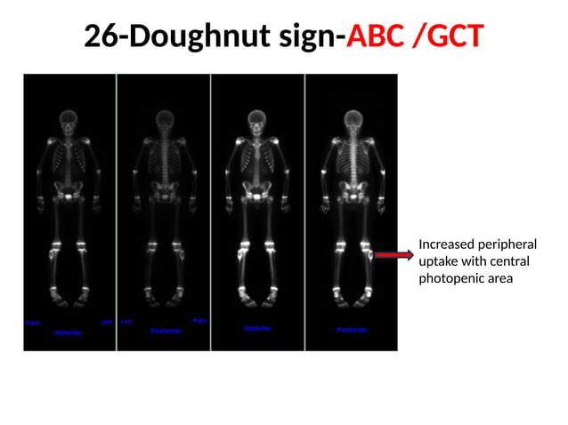 RADIOLOGY SIGNS JULY24 signs signs signed.pptx