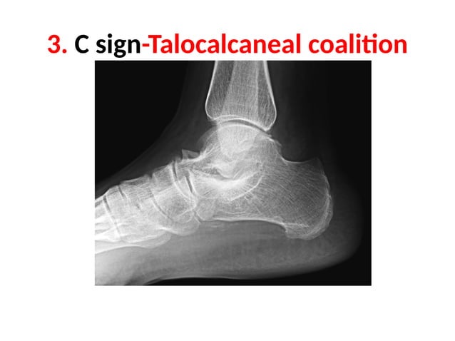 RADIOLOGY SIGNS JULY24 signs signs signed.pptx