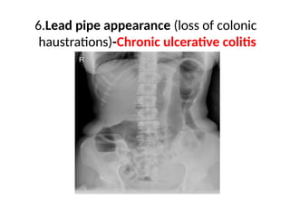 RADIOLOGY SIGNS JULY24 signs signs signed.pptx