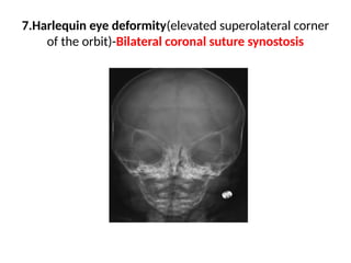 RADIOLOGY SIGNS JULY24 signs signs signed.pptx