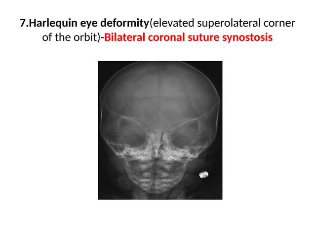 RADIOLOGY SIGNS JULY24 signs signs signed.pptx | Free Download