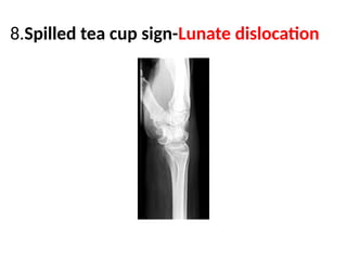 RADIOLOGY SIGNS JULY24 signs signs signed.pptx