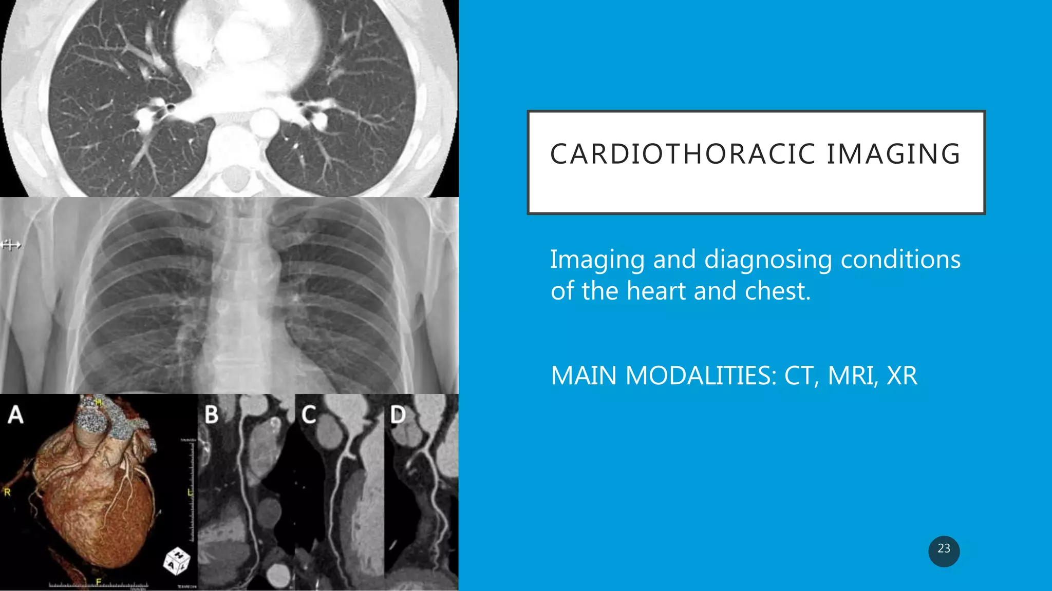 Radiology spotlight | PPTX