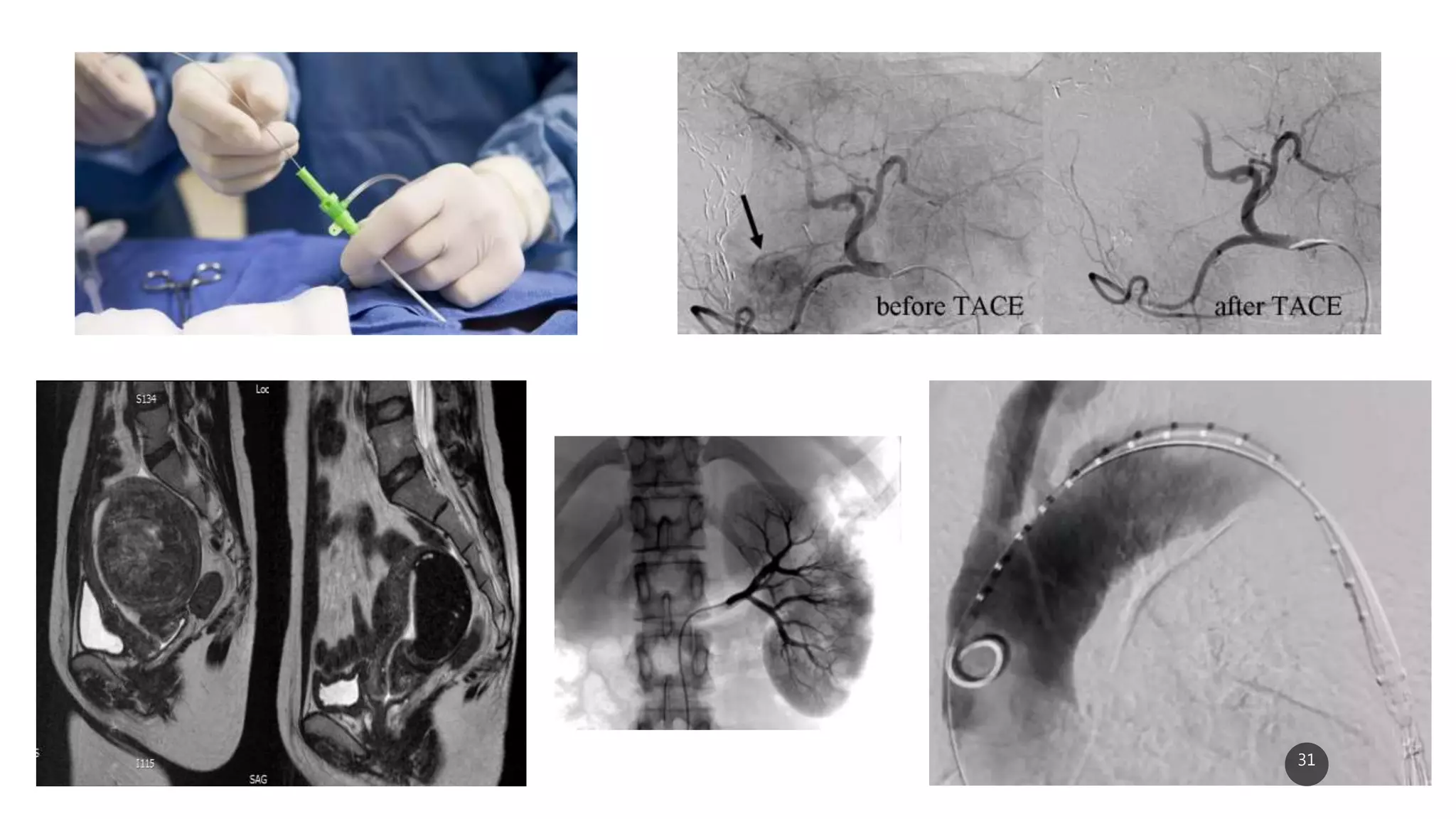 Radiology spotlight | PPTX