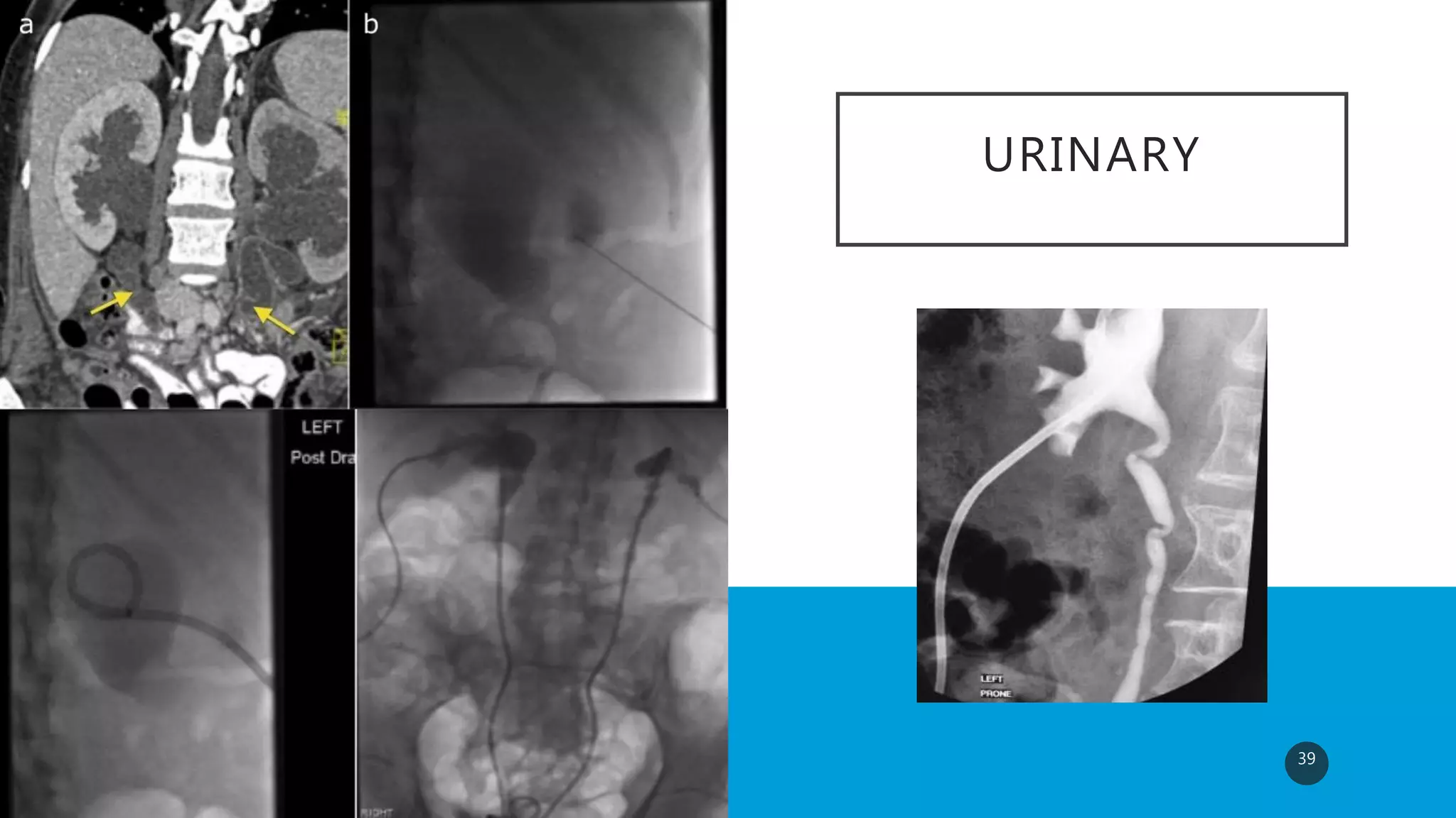 Radiology spotlight | PPTX