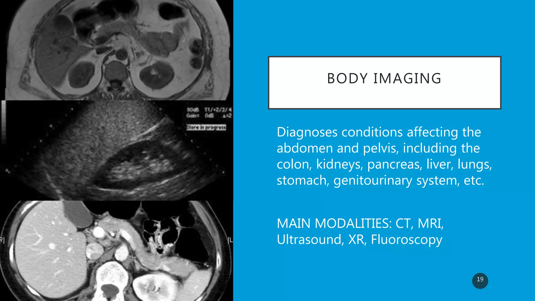Radiology spotlight v2 | PPTX