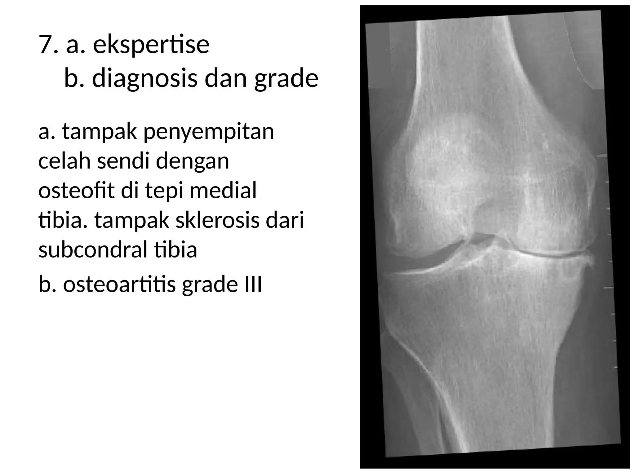 radiology contoh soal stase radiologi .pptx