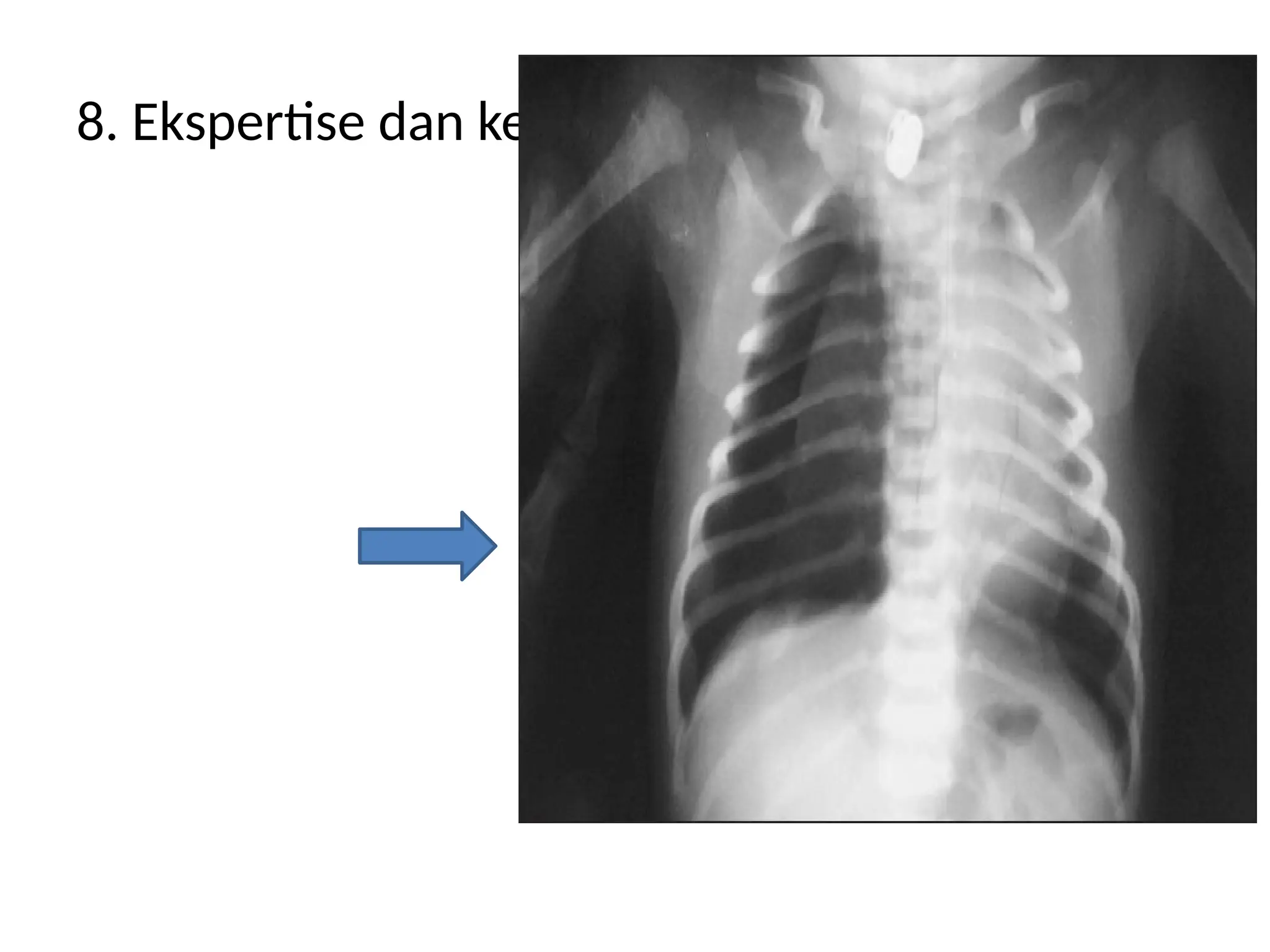 radiology contoh soal stase radiologi .pptx