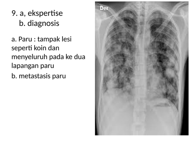 radiology contoh soal stase radiologi .pptx