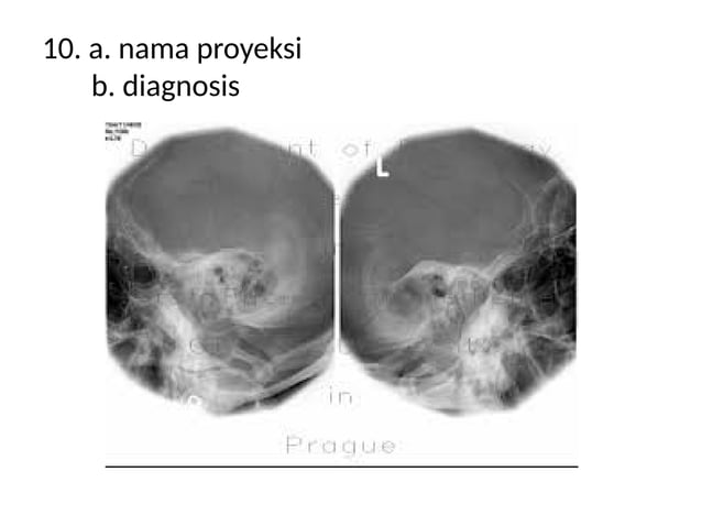 radiology contoh soal stase radiologi .pptx