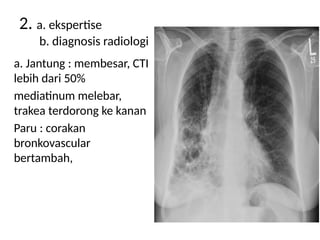radiology contoh soal stase radiologi .pptx