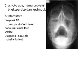 radiology contoh soal stase radiologi .pptx