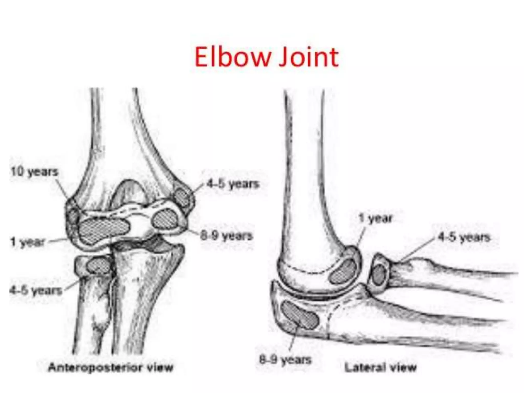 Radiology upper limb | PPTX