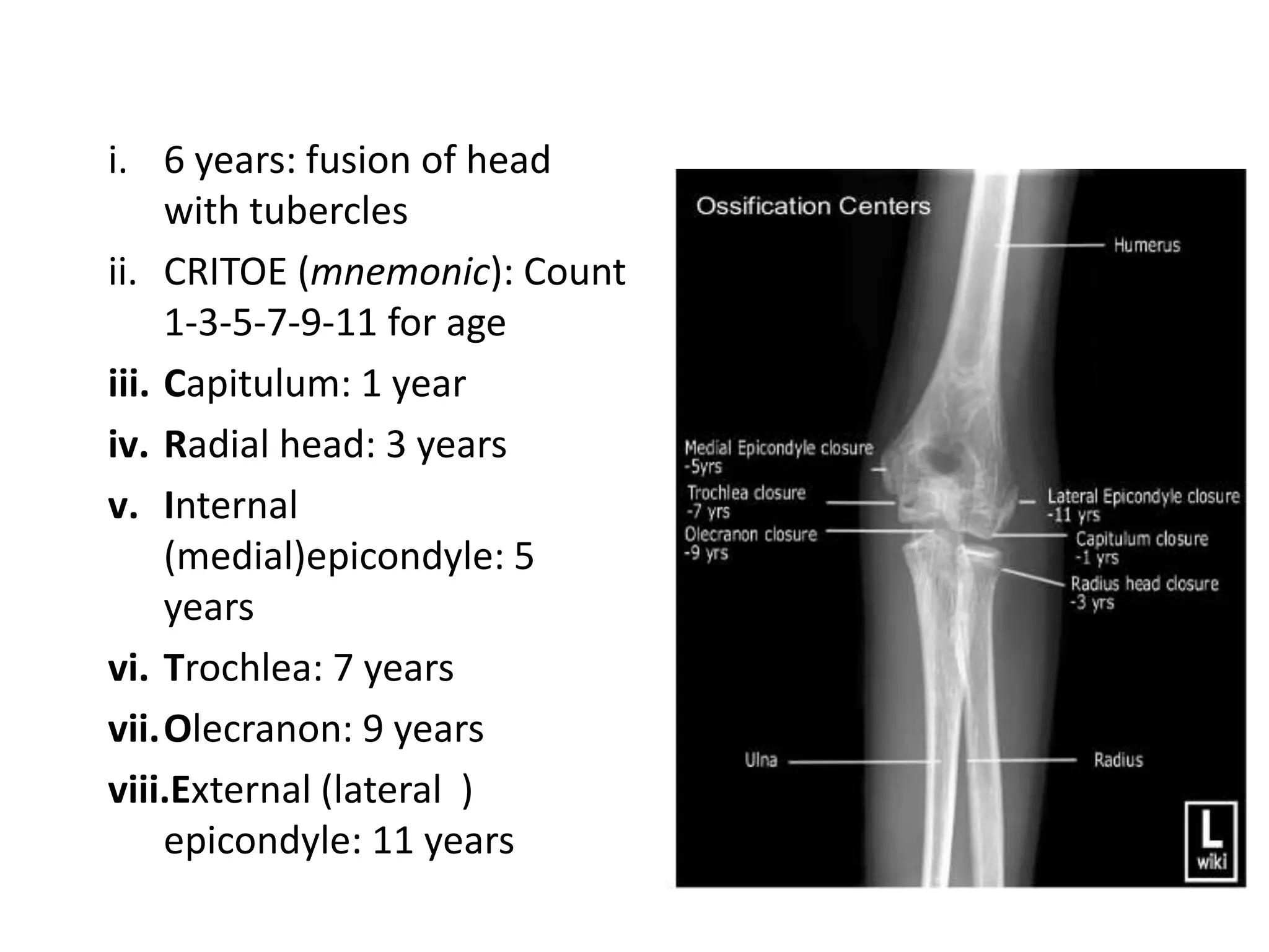 Radiology upper limb | PPTX