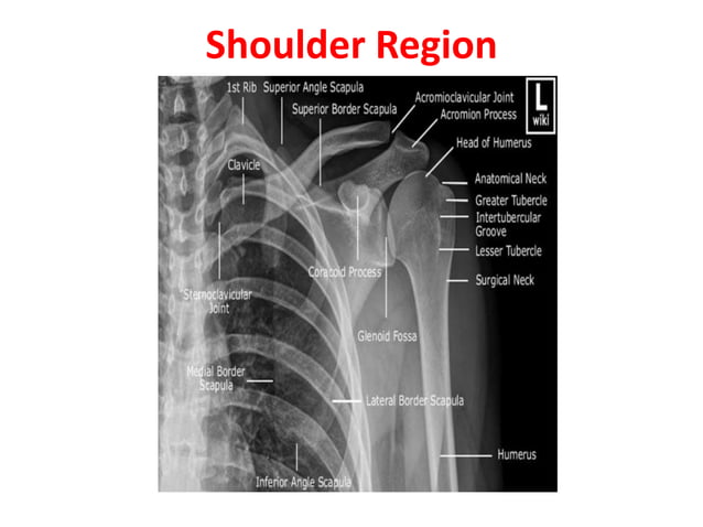 Radiology upper limb | PPTX