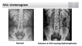 Radiology Urinary system Presentation 2022 (2).pptx