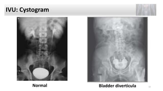 Radiology Urinary system Presentation 2022 (2).pptx