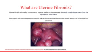 Diagnostic Imaging in Uterine fibroids | POTX