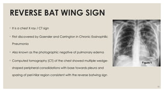 Radiology Lot Class: Key Radiological Signs in Pulmonary Medicine | PPTX