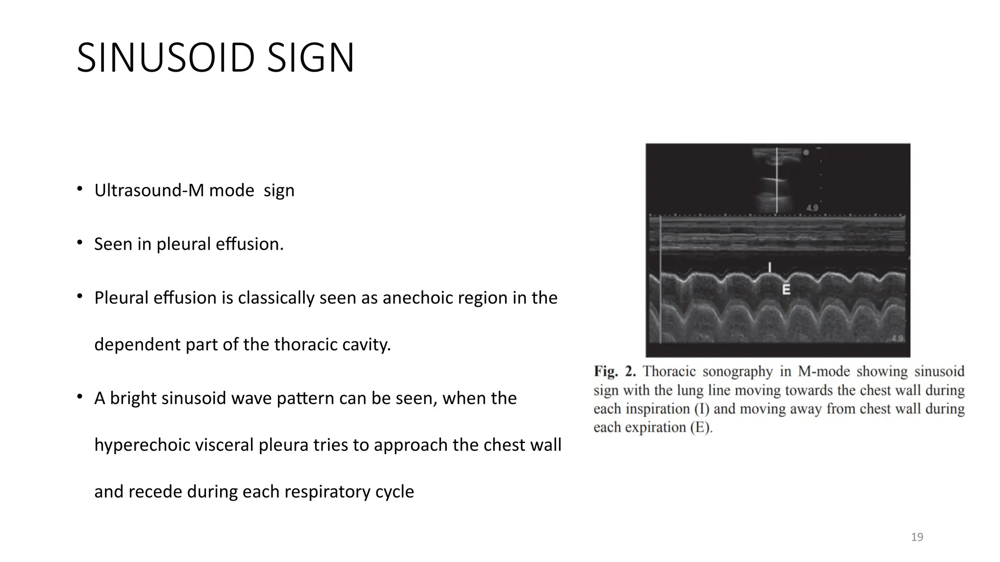 Radiology in pulmo cases part 2 in depth | PPTX