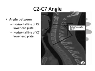 Radiological measurements | PPTX