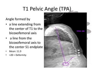 Radiological measurements | PPTX