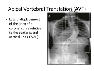 Radiological measurements | PPTX