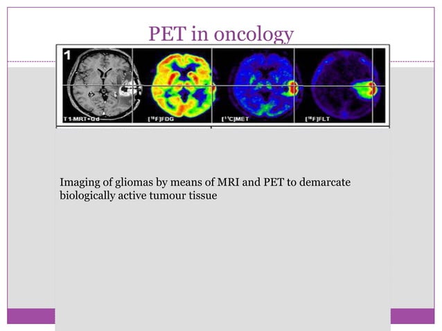 Radionucleide imaging of the brain | PPTX