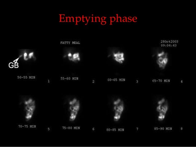 Radionuclide imaging