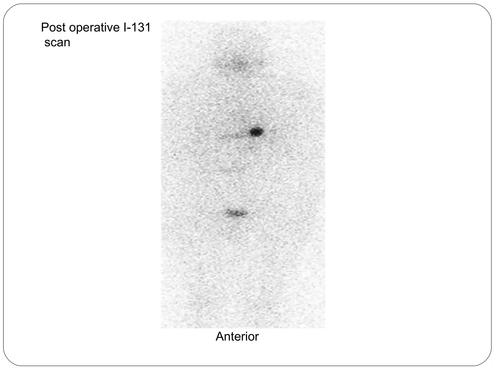 Radionuclide imaging thyroid & parathyroid | PPT