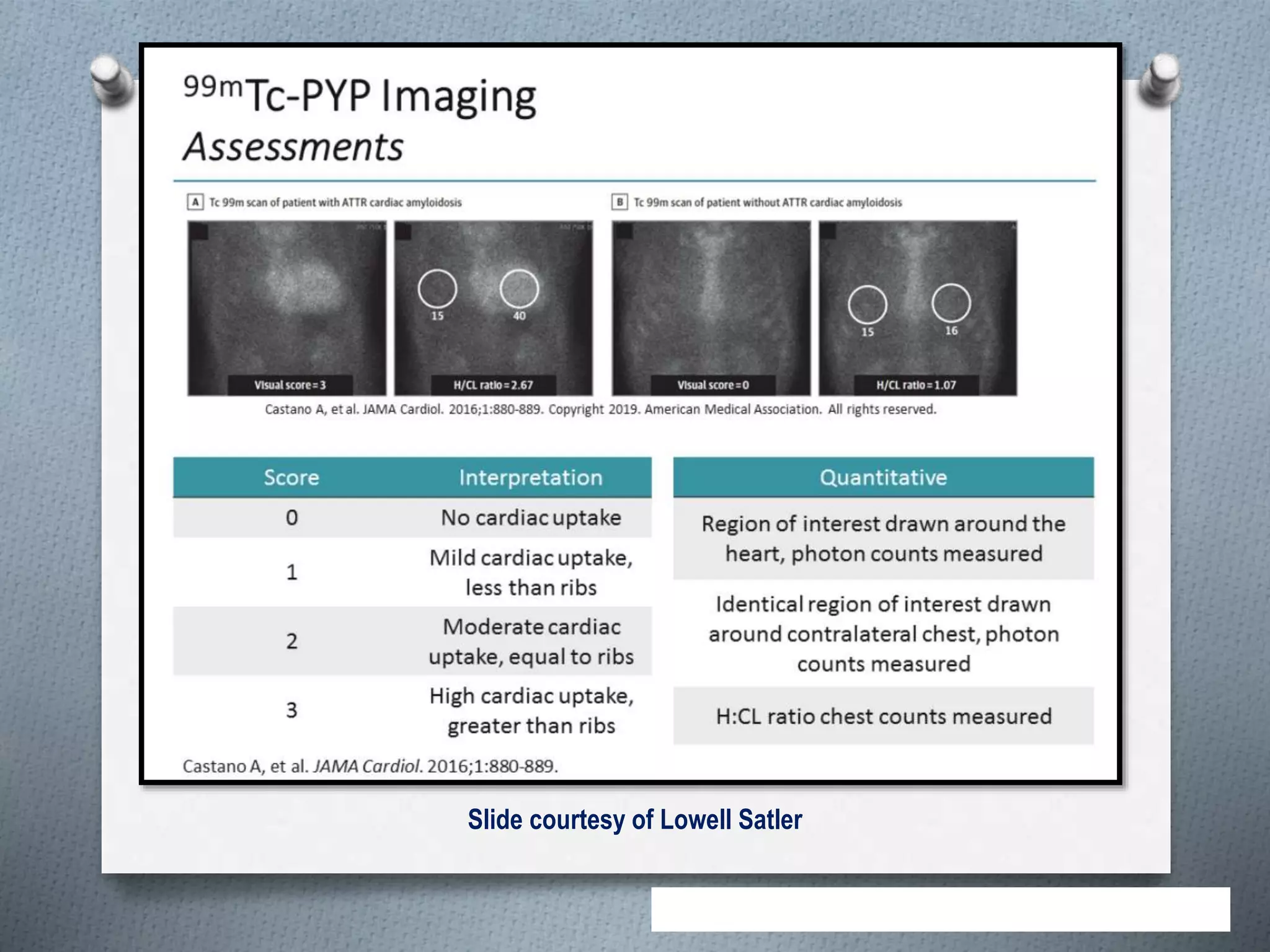Radionuclide Imaging of Cardiac Amyloidosis and SarcoidosisFELLOWS ...