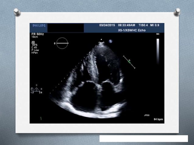Radionuclide Imaging of Cardiac Amyloidosis and SarcoidosisFELLOWS ...