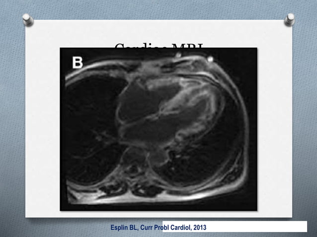 Radionuclide Imaging of Cardiac Amyloidosis and SarcoidosisFELLOWS ...