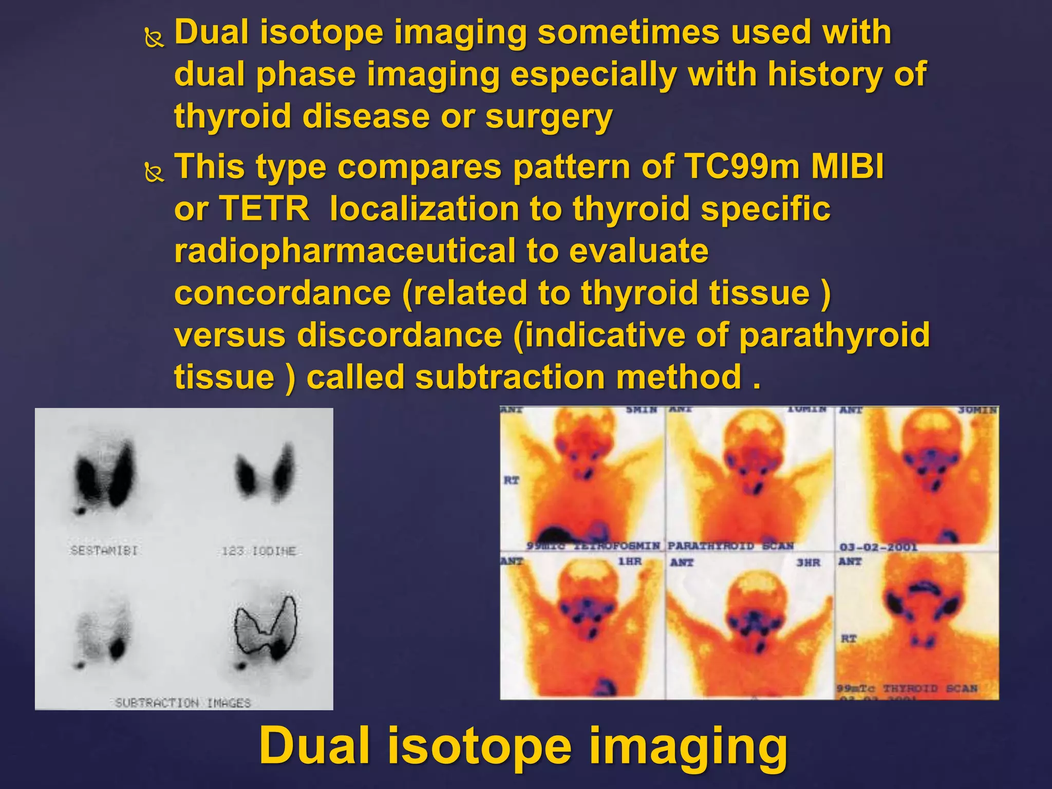 Radionuclide imaging of parathyroid glands | PPTX