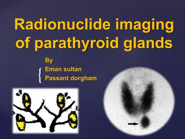 Radionuclide imaging of parathyroid glands | PPTX