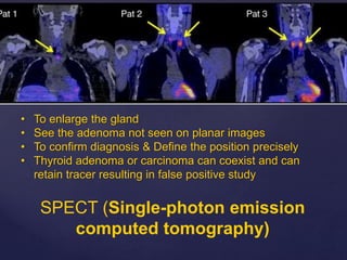 Radionuclide imaging of parathyroid glands | PPTX