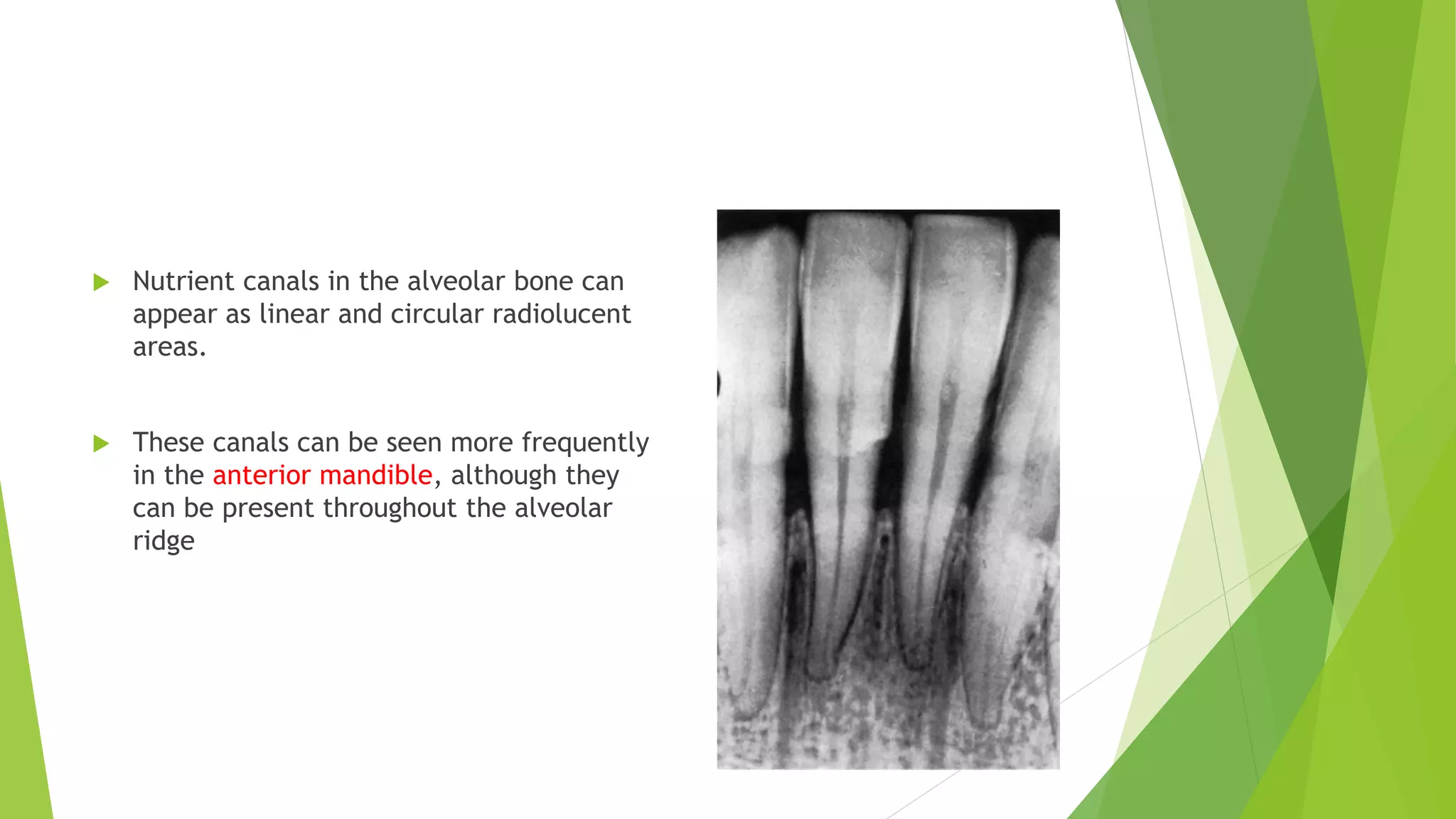 Radiographic aids in the diagnosis of periodontal disease | PPTX