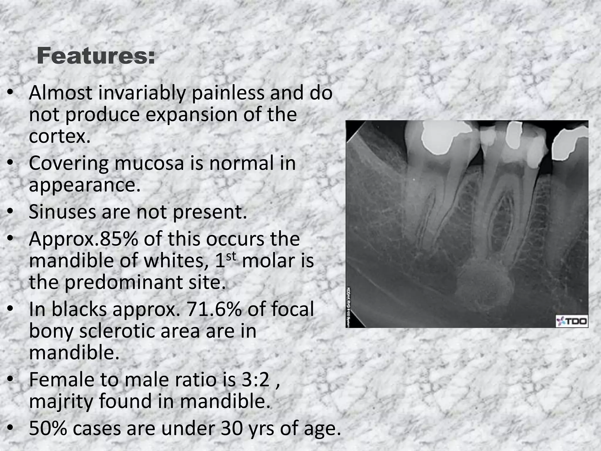 Radiopaque Lesions | PPTX