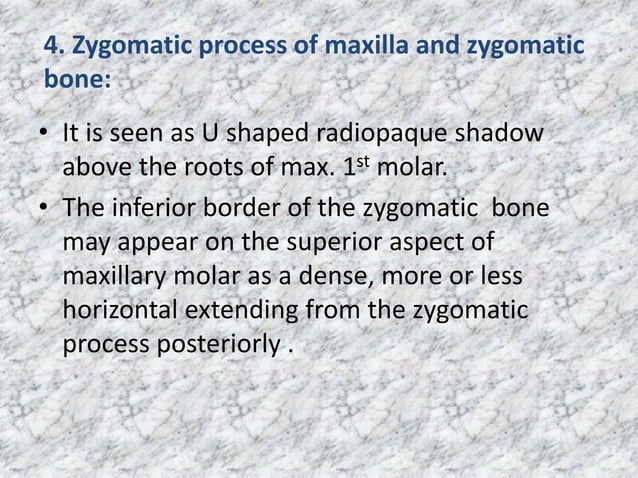 Radiopaque Lesions | PPTX | Dental Health | Diseases and Conditions