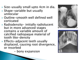 Radiopacities of jaws | PPTX