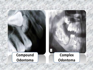 radiopacity lesions : radiology lecture. | PPTX | Bone and Joint ...