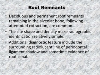 radiopacity lesions : radiology lecture. | PPTX | Bone and Joint ...