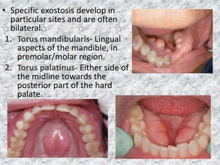 radiopacity lesions : radiology lecture. | PPTX
