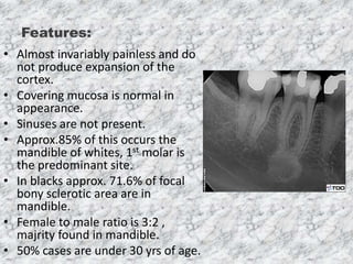 radiopacity lesions : radiology lecture. | PPTX | Bone and Joint ...