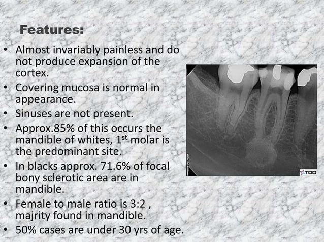 radiopacity lesions : radiology lecture. | PPTX | Bone and Joint ...