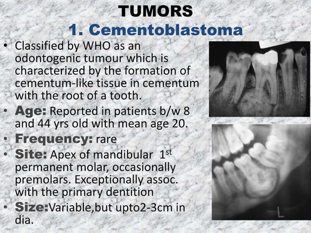 radiopacity lesions : radiology lecture. | PPTX | Bone and Joint ...