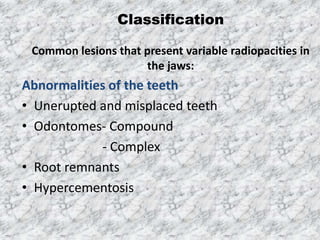 radiopacity lesions : radiology lecture. | PPT